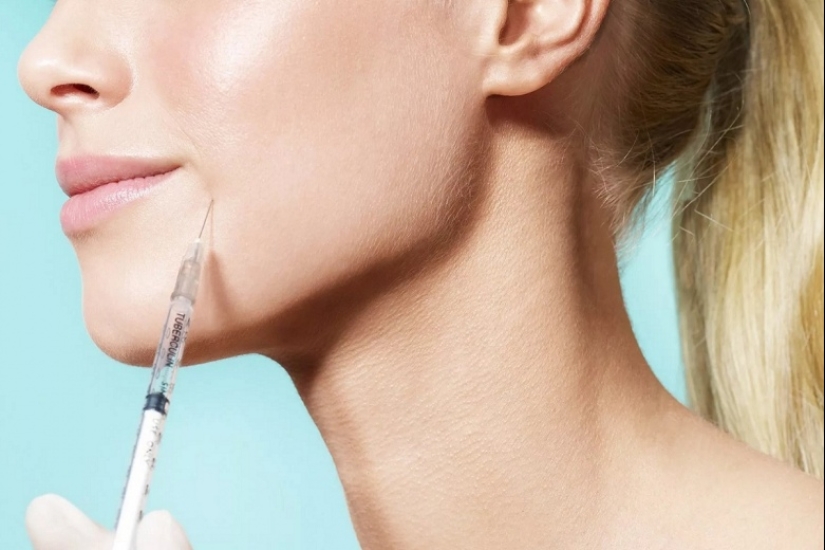 How do dimples appear on cheeks, and can they be made or removed - Pictolic