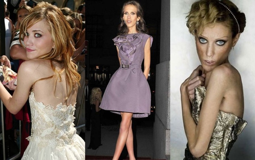 They were afraid to get fat: 9 stars who were ruined by anorexia - Pictolic